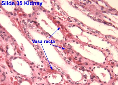 Urinary 9602